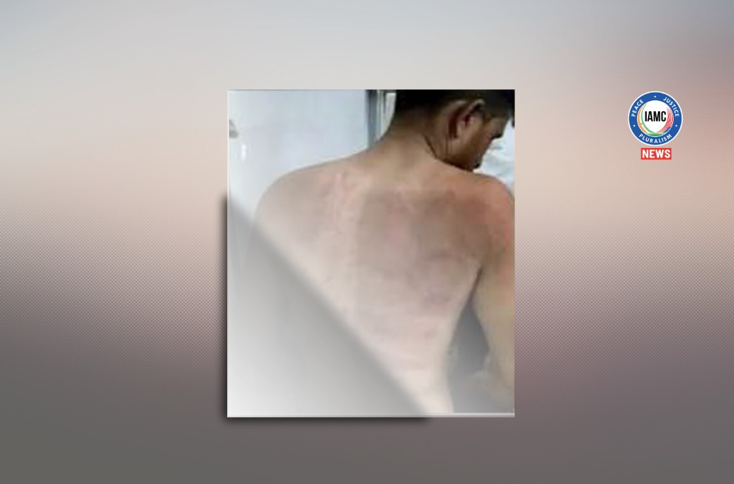 Muslim cattle trader assaulted by Hindu militants in Karnataka - IAMC Muslim cattle trader assaulted by Hindu militants in Karnataka - IAMC